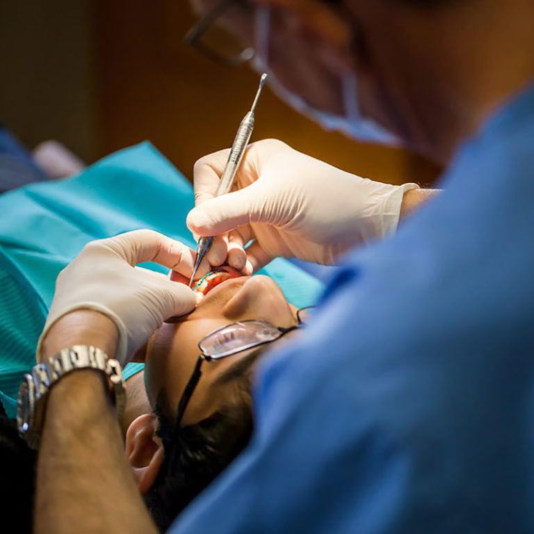 TEMPORARY ANCHORAGE DEVICES - Ziedenberg Orthodontics